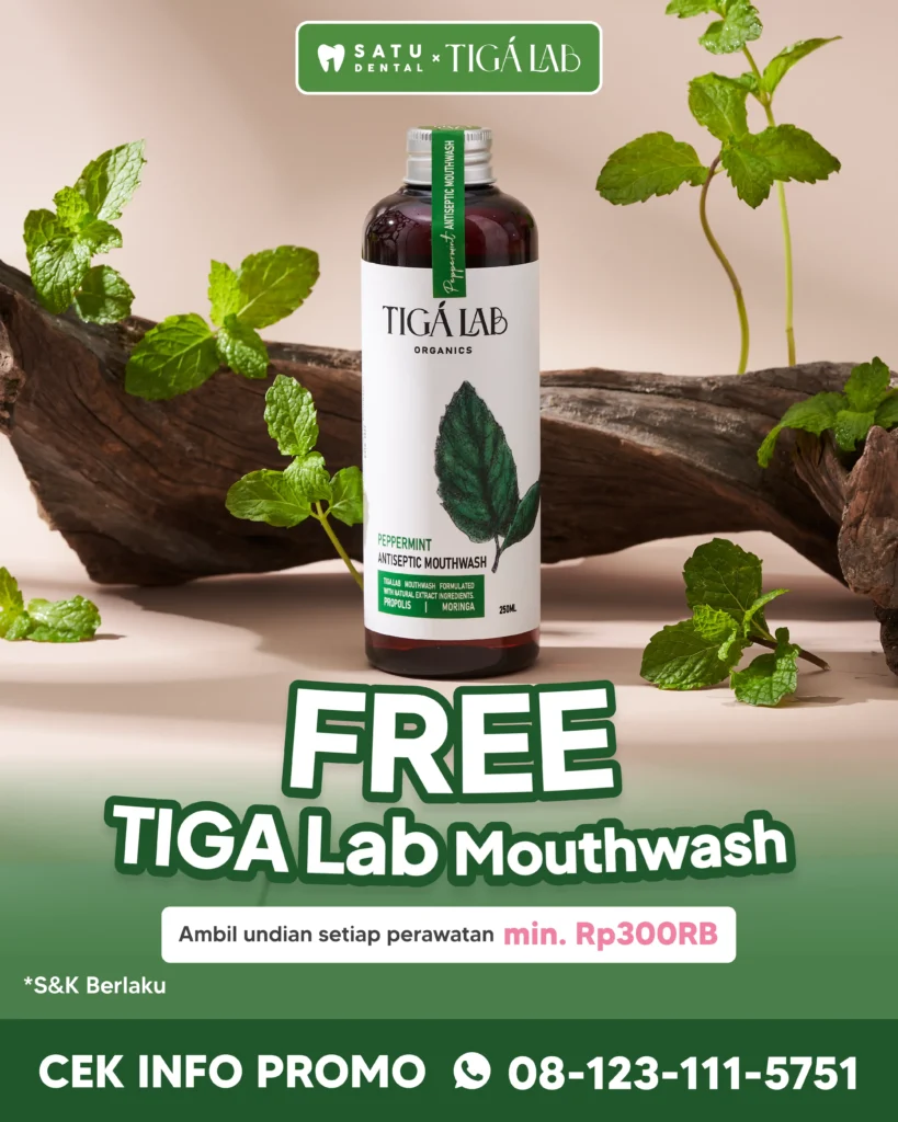 Promo SATU Dental X Tiga Lab Undian - Klinik Gigi SATU Dental